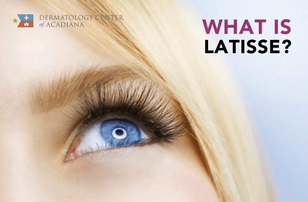 Eyelash Enhancement 101: All About Latisse