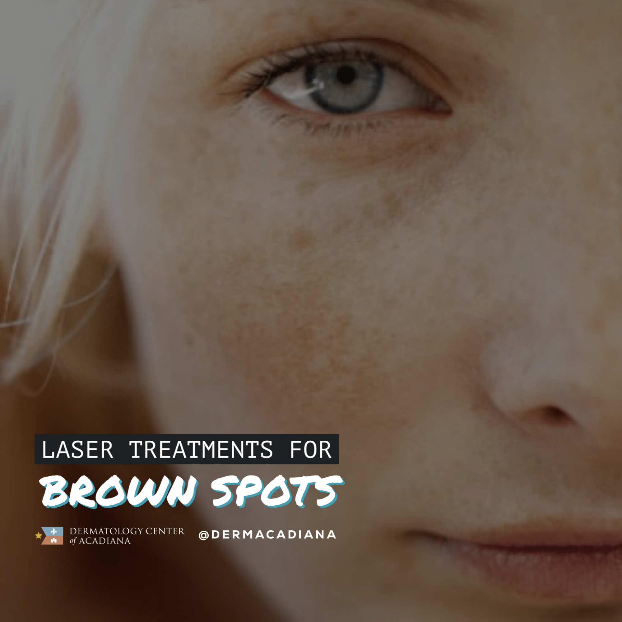 Laser Treatment: 8 Skin Issues You Can Treat with a Laser